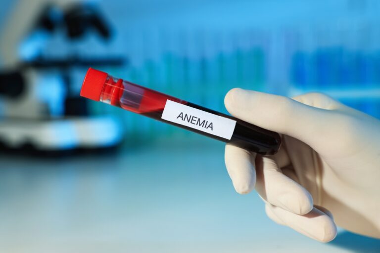 Anemia in the Elderly: 4 Things You Need To Know - Indulging Health